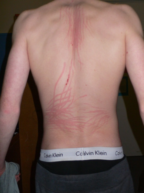 Back Scratches And Hickies Tumblr